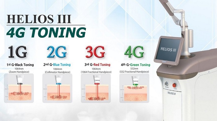 Máy laser yag Helios III (LH: 0902100329)